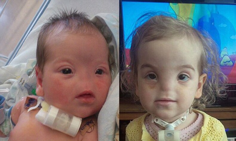 De Ierse Tessa (2) krijgt een neus | Libelle