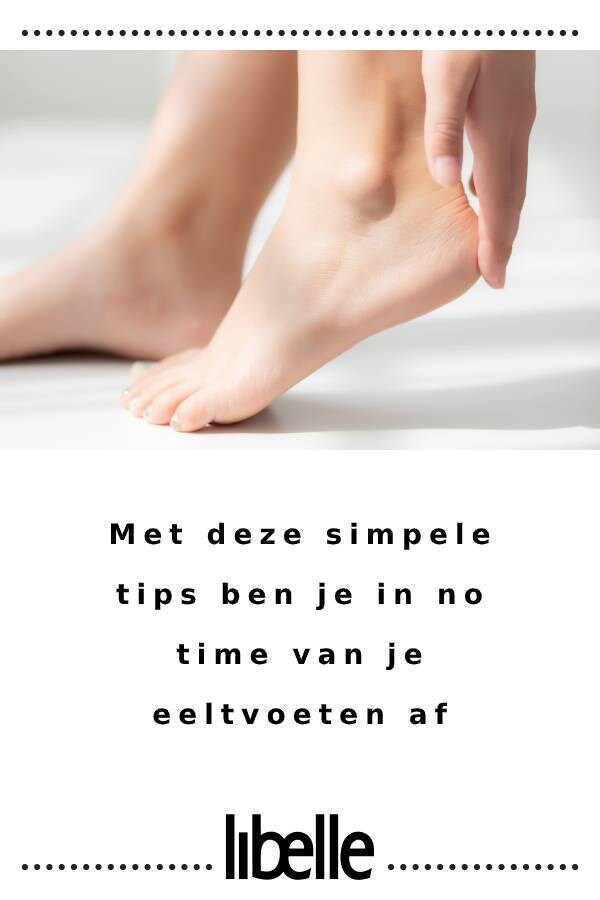 Eelt verwijderen: zo kun je dat het beste doen | Libelle