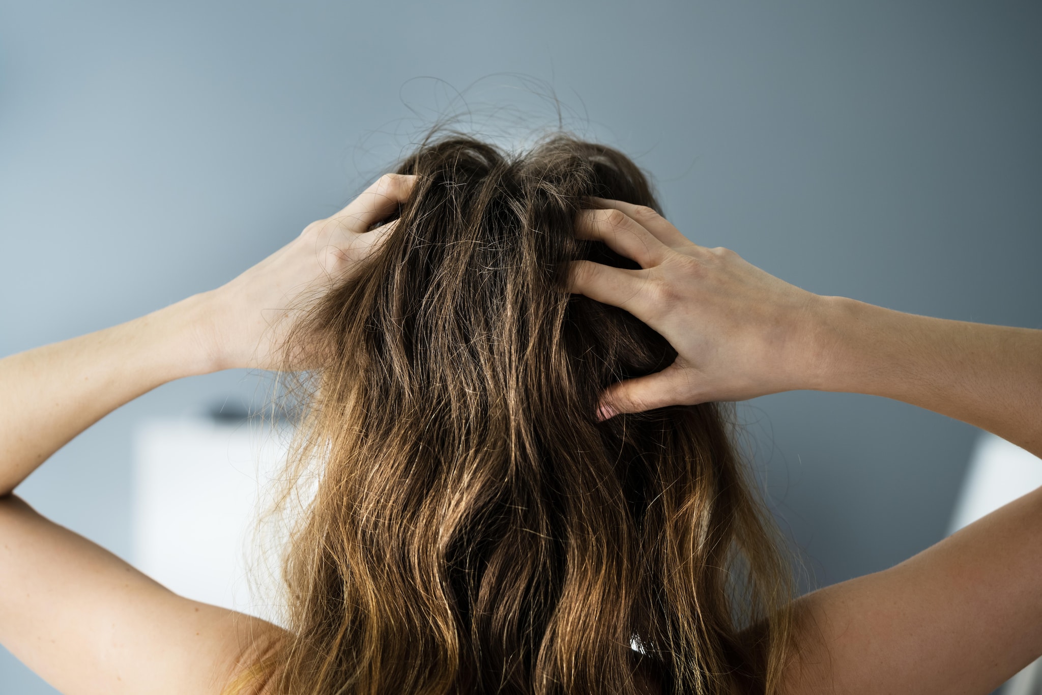 Last van je hoofdhuid? Déze 7 aandoeningen kunnen de oorzaak zijn