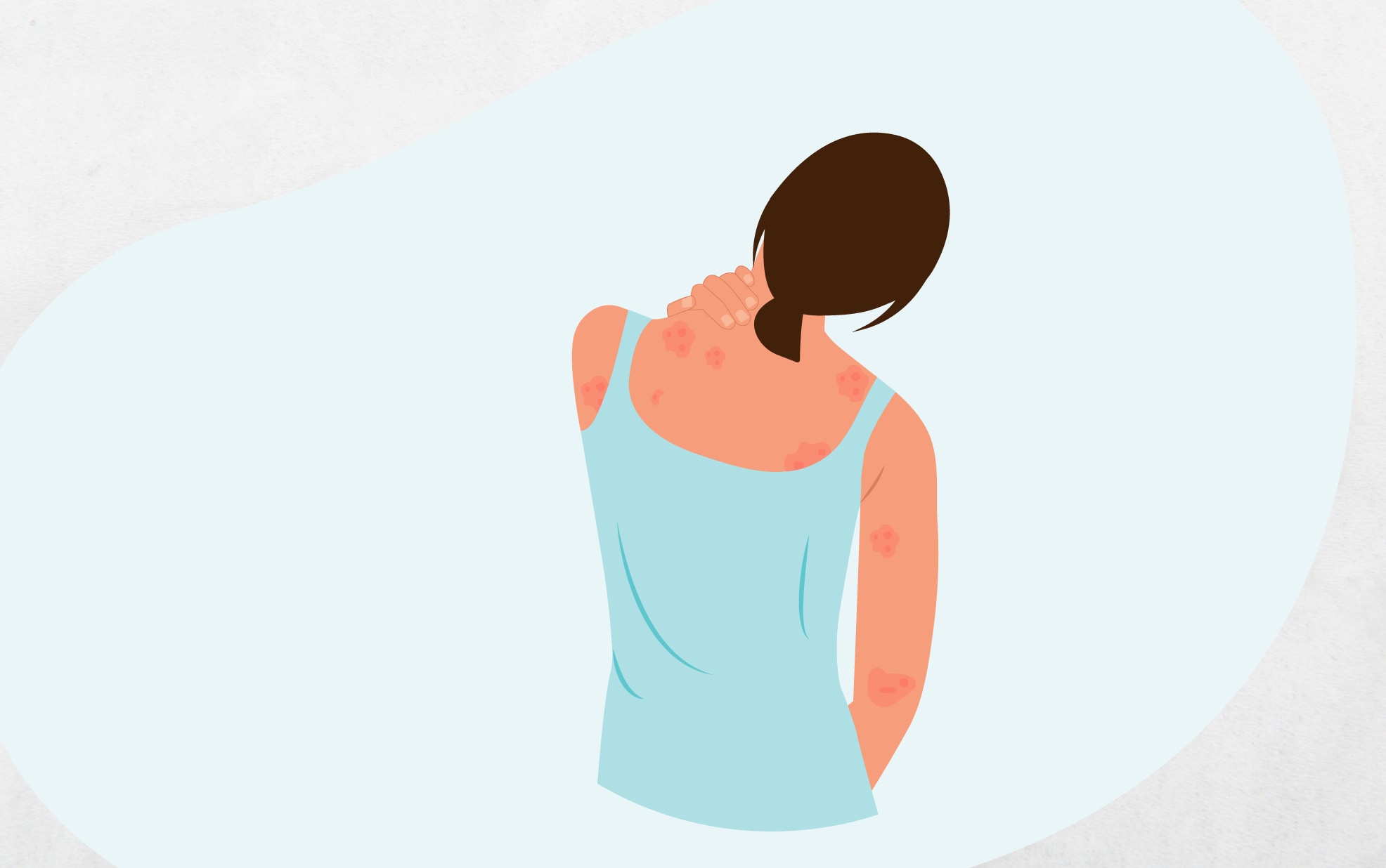 Wat zijn smetplekken en wat kun je er tegen doen? | Libelle