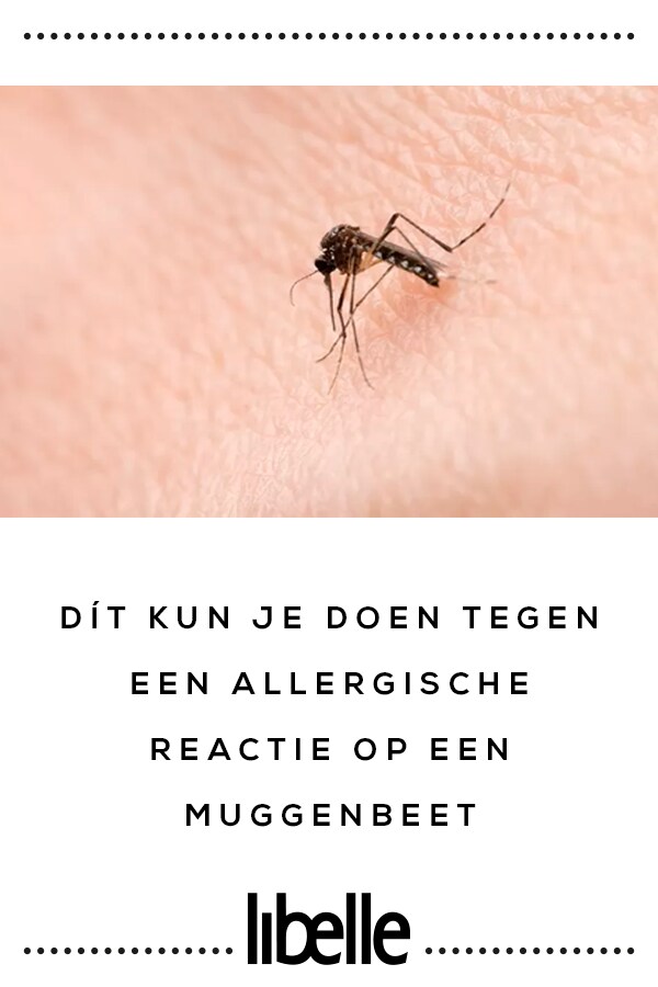 Allergische reactie op een muggenbeet? Dit kun het beste doen | Libelle