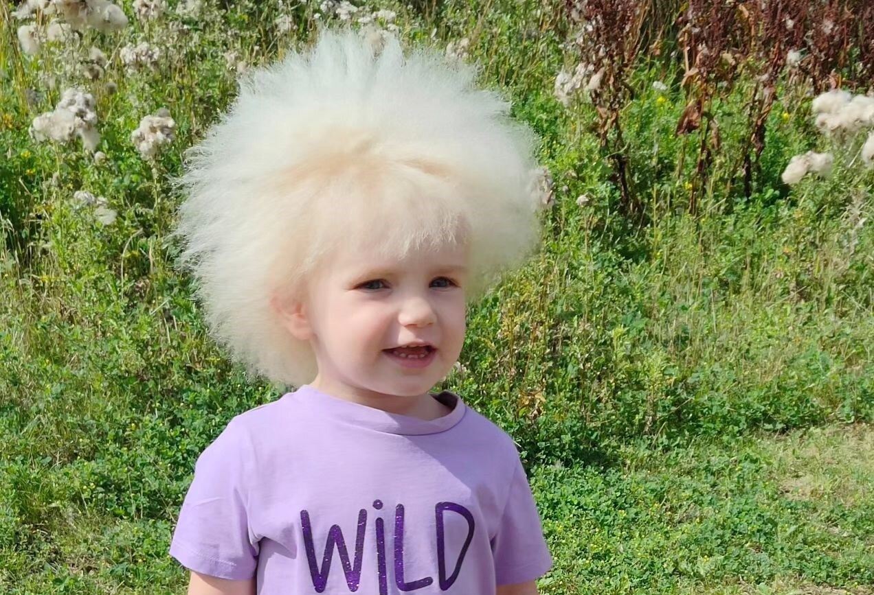 Slechts 100 mensen hebben net zulk bijzonder haar als Layla | Libelle