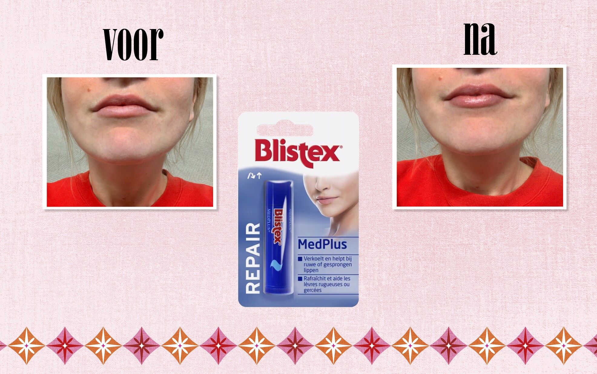 Libelle’s lippenbalsem test: wat zijn de beste lippenbalsems volgens de ...